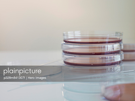 Stack of petri dishes - Stock Image - Everypixel